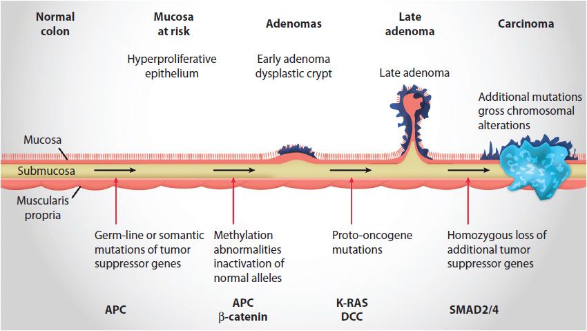 52 Cancer Biology | Basicmedical Key
