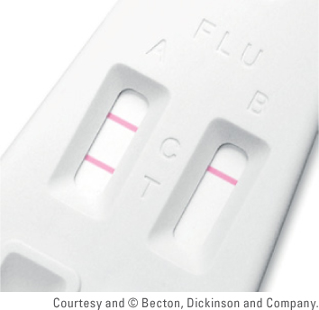 Influenza Viruses | Basicmedical Key