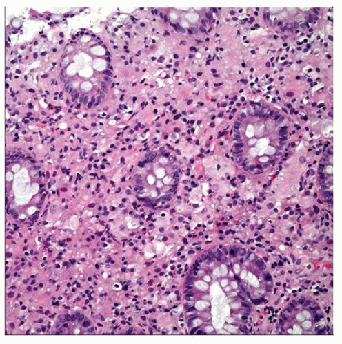Histoplasma | Basicmedical Key