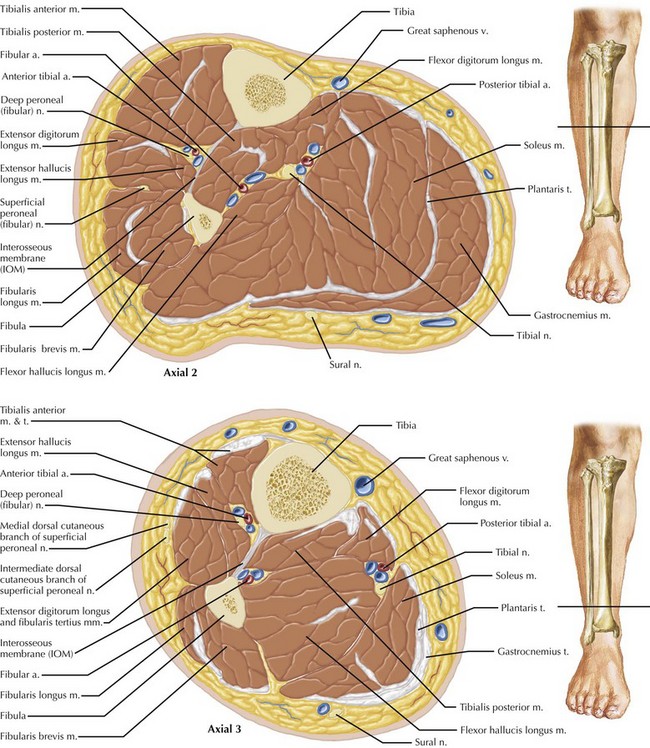 Leg And Forearm Fasciotomy Basicmedical Key Leg And Forearm Fasciotomy Basicmedical Key