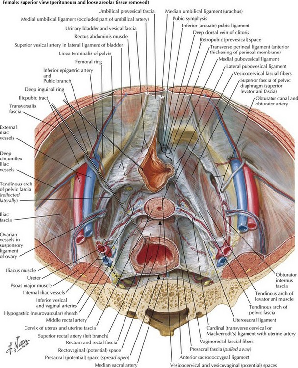 Right Colectomy Basicmedical Key
