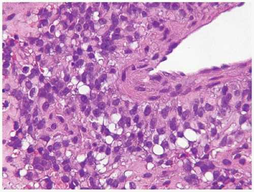 C12-FF69.gif | Basicmedical Key