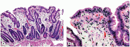 C14-FF40.gif | Basicmedical Key