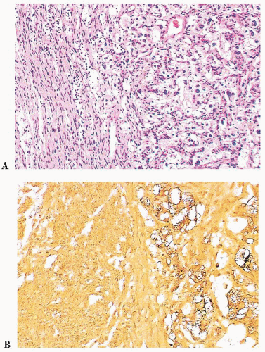 C15-FF29.gif | Basicmedical Key