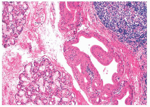 C20-FF9.gif | Basicmedical Key