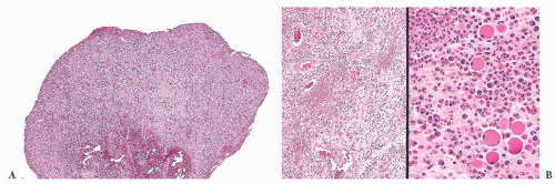 Ear and Temporal Bone | Basicmedical Key