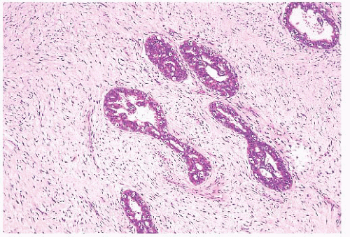 C9-FF100.gif | Basicmedical Key