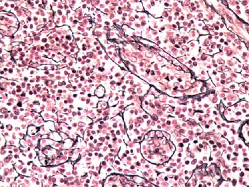 The Normal Lymph Node Basicmedical Key