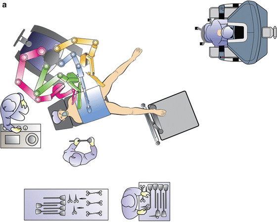 Robotic Left Colectomy Basicmedical Key