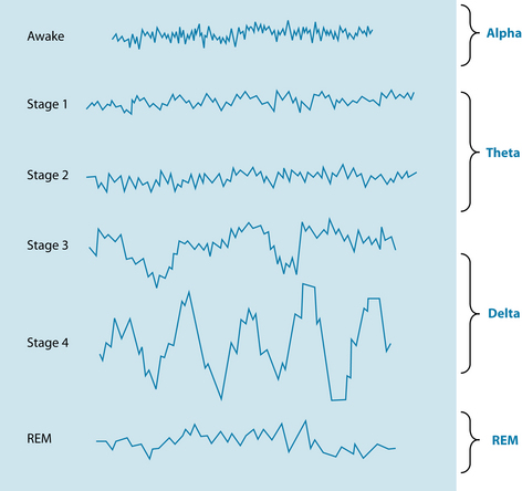 Insomnia Basicmedical Key