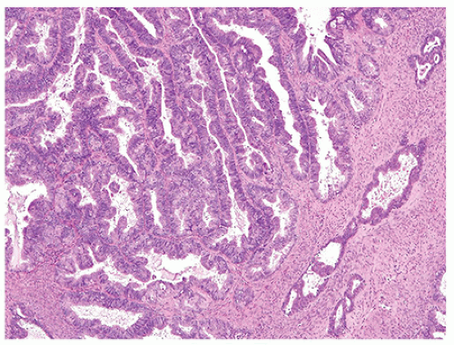 C1-FF138.gif | Basicmedical Key