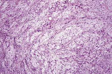 f009009-006-9781455725014.jpg | Basicmedical Key